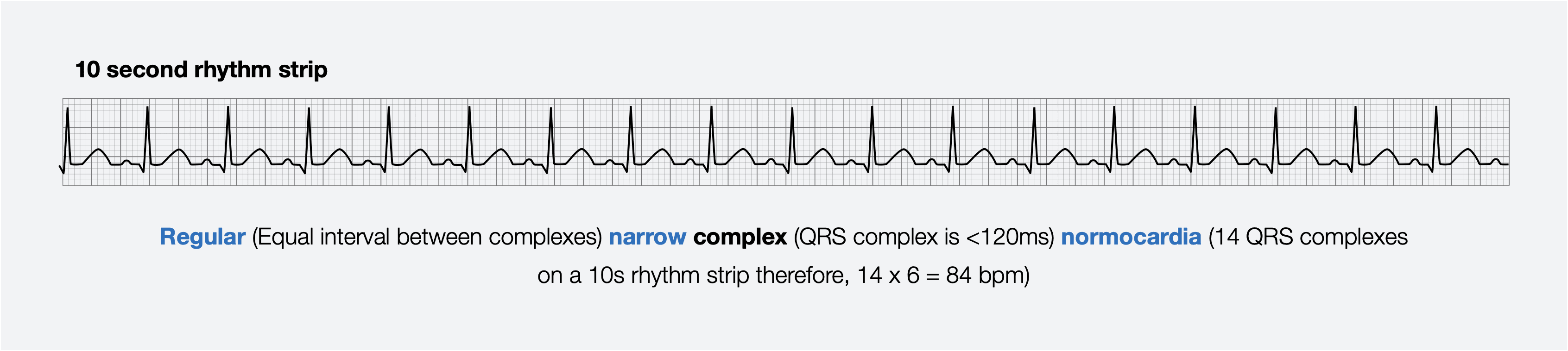 Approach to an ECG summary - ECG In Minutes