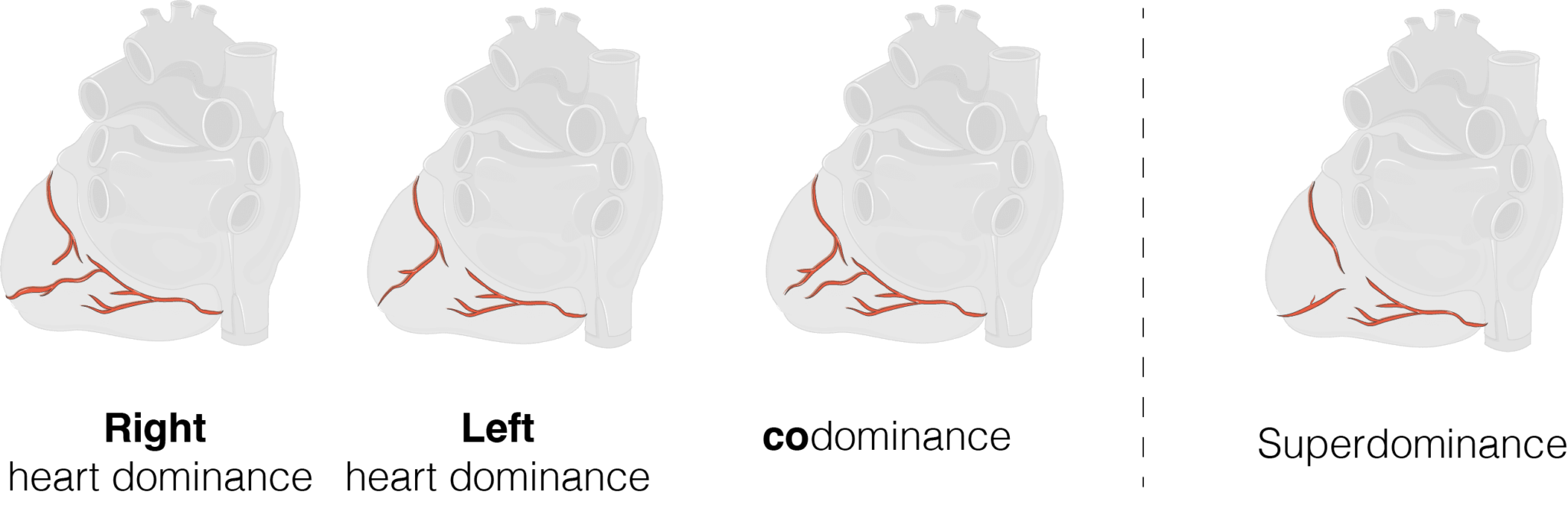 Cardiac dominance – Four Minute Medicine