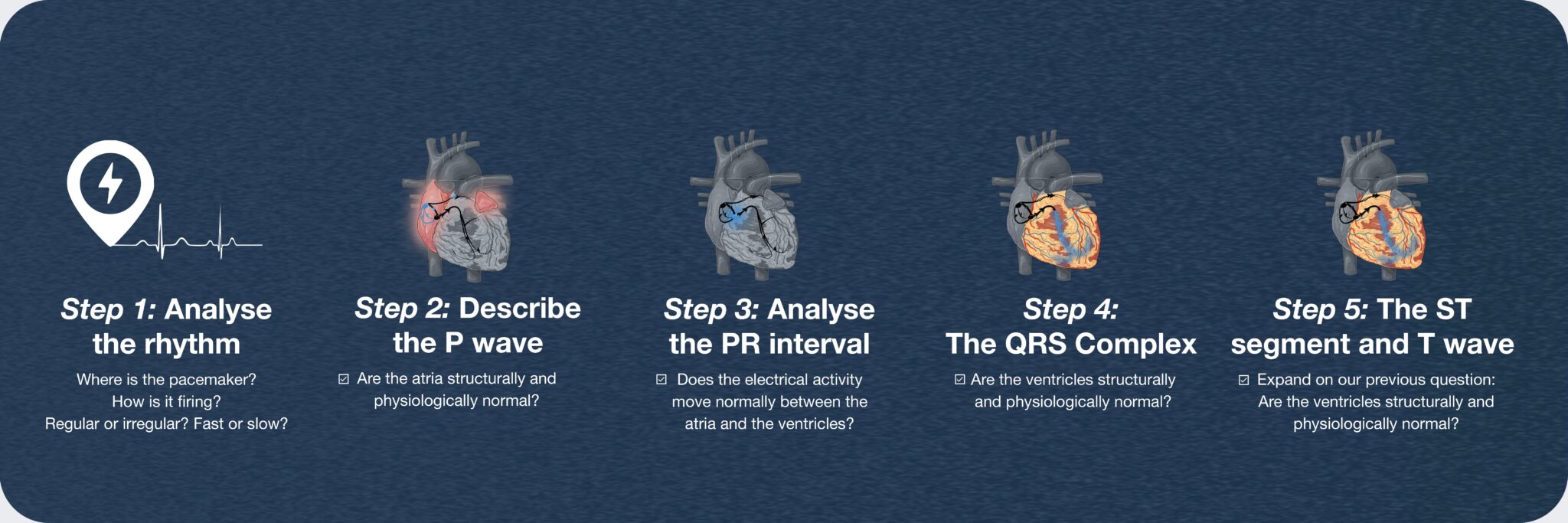 How to read ECGs: Our 5-Step-process